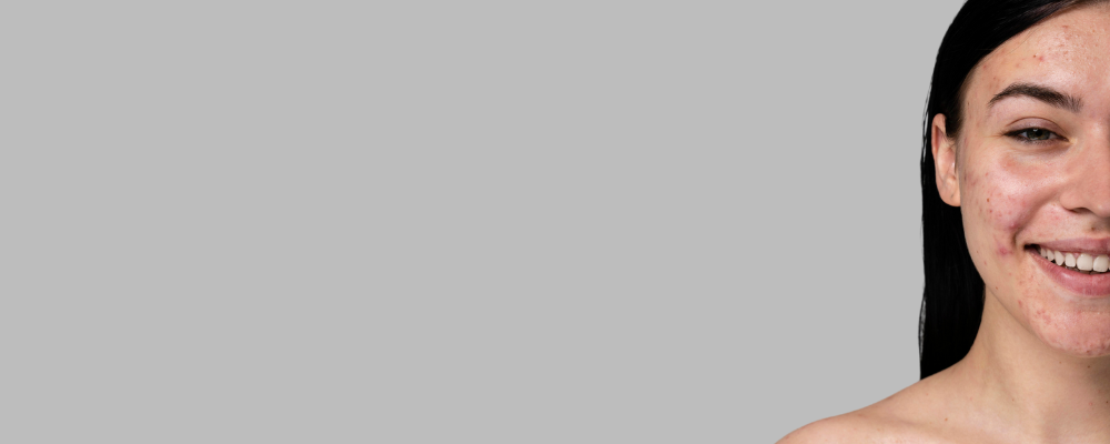 Keratoregulateur BOOST - SlimFOX